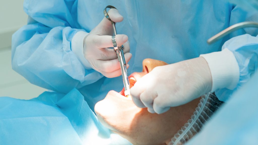Root Amputation - Chapel Hill Periodontics & Implants